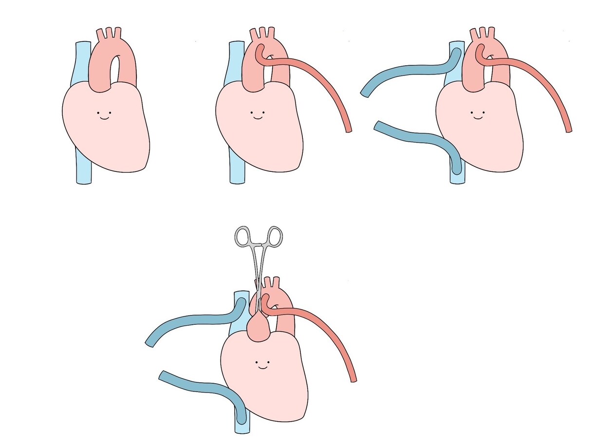 医師監修×正確でわかりやすい医療イラスト制作します 学会、論文、患者説明に最適です